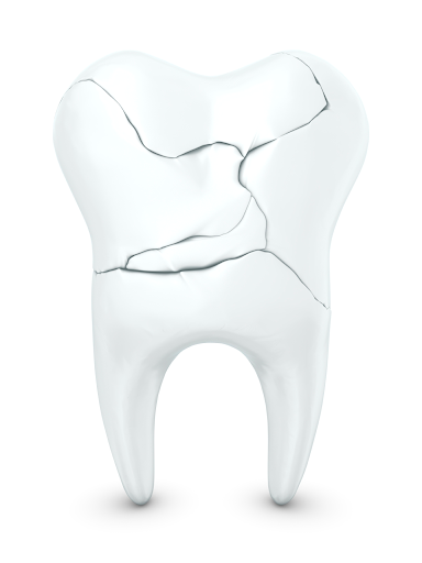 Chipped / Broken Teeth – Bridgewater Dental Centre